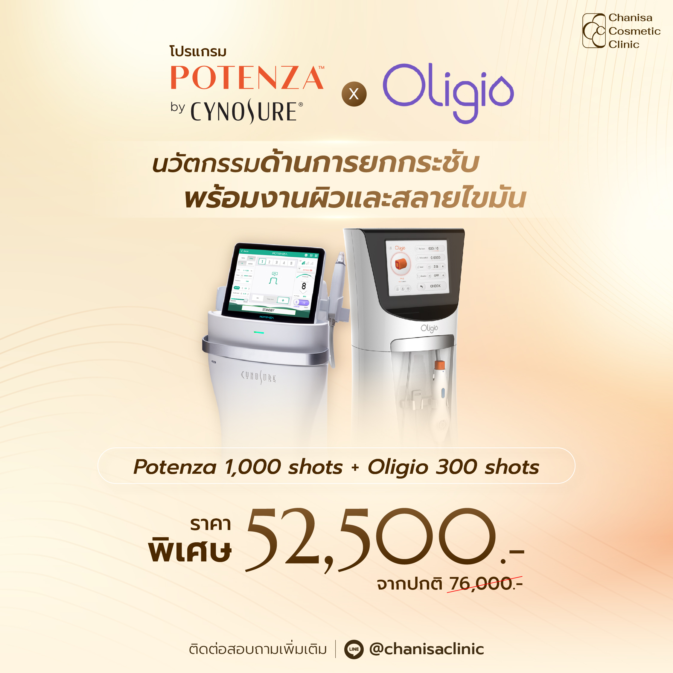 Potenza เครื่องยกกระชับพร้อมงานผิวกระจก - Chanisa Cosmetic Clinic